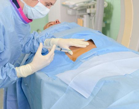 Biopsie et ponction